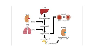 Edema pathogenesis,causes, approach.pptx