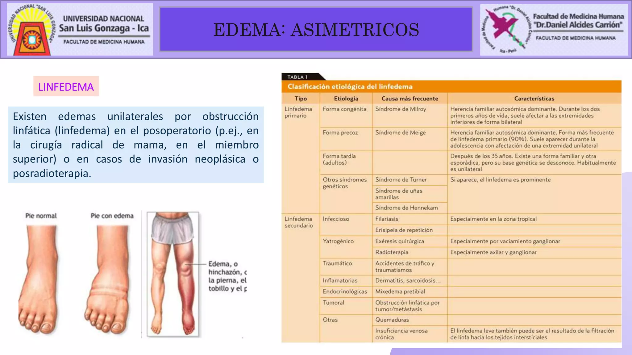 EDEMA_FISIOPATOLOGiATIPOS_Y_CARACTERSTICAS.pptx
