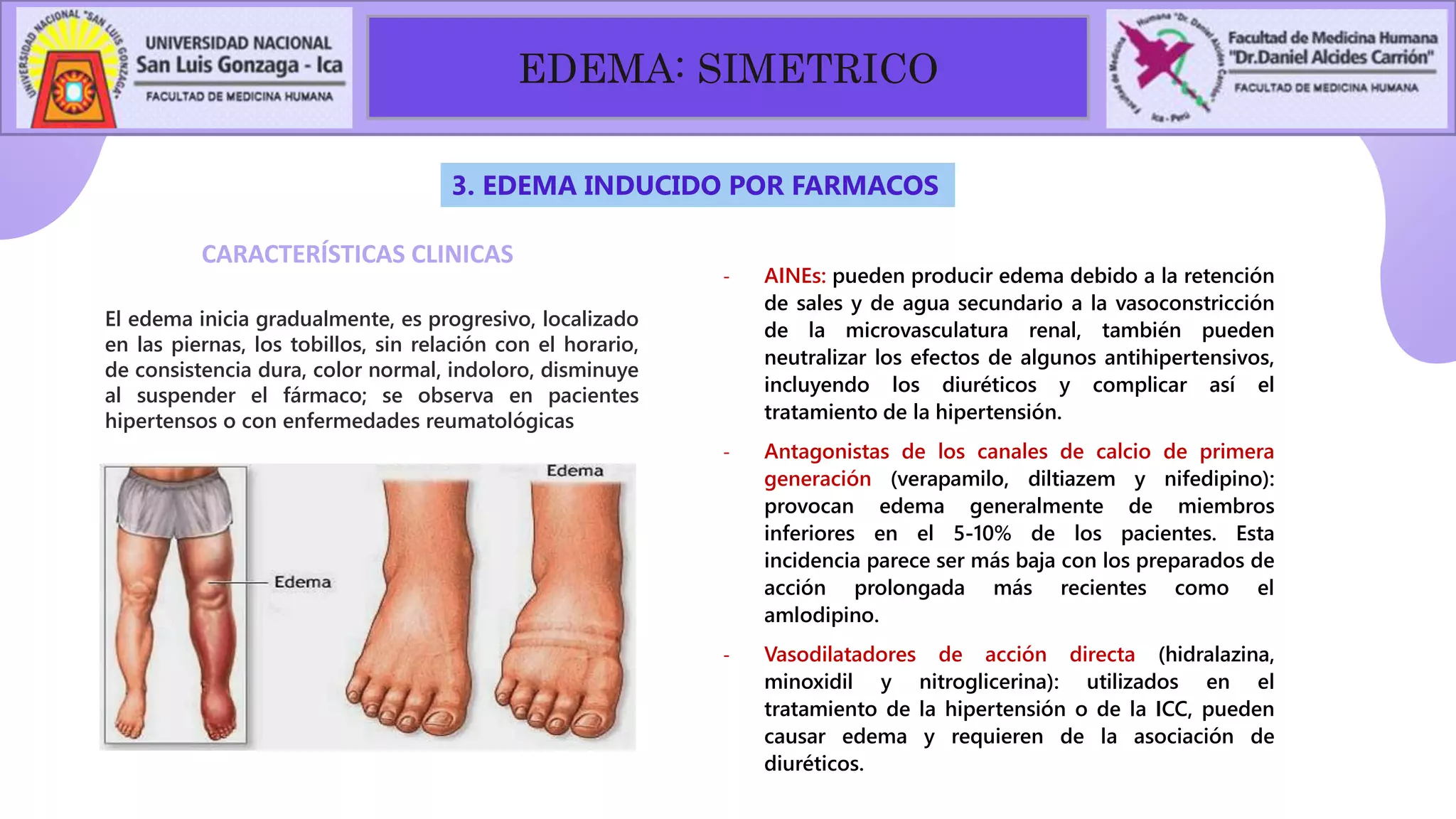 EDEMA_FISIOPATOLOGiATIPOS_Y_CARACTERSTICAS.pptx