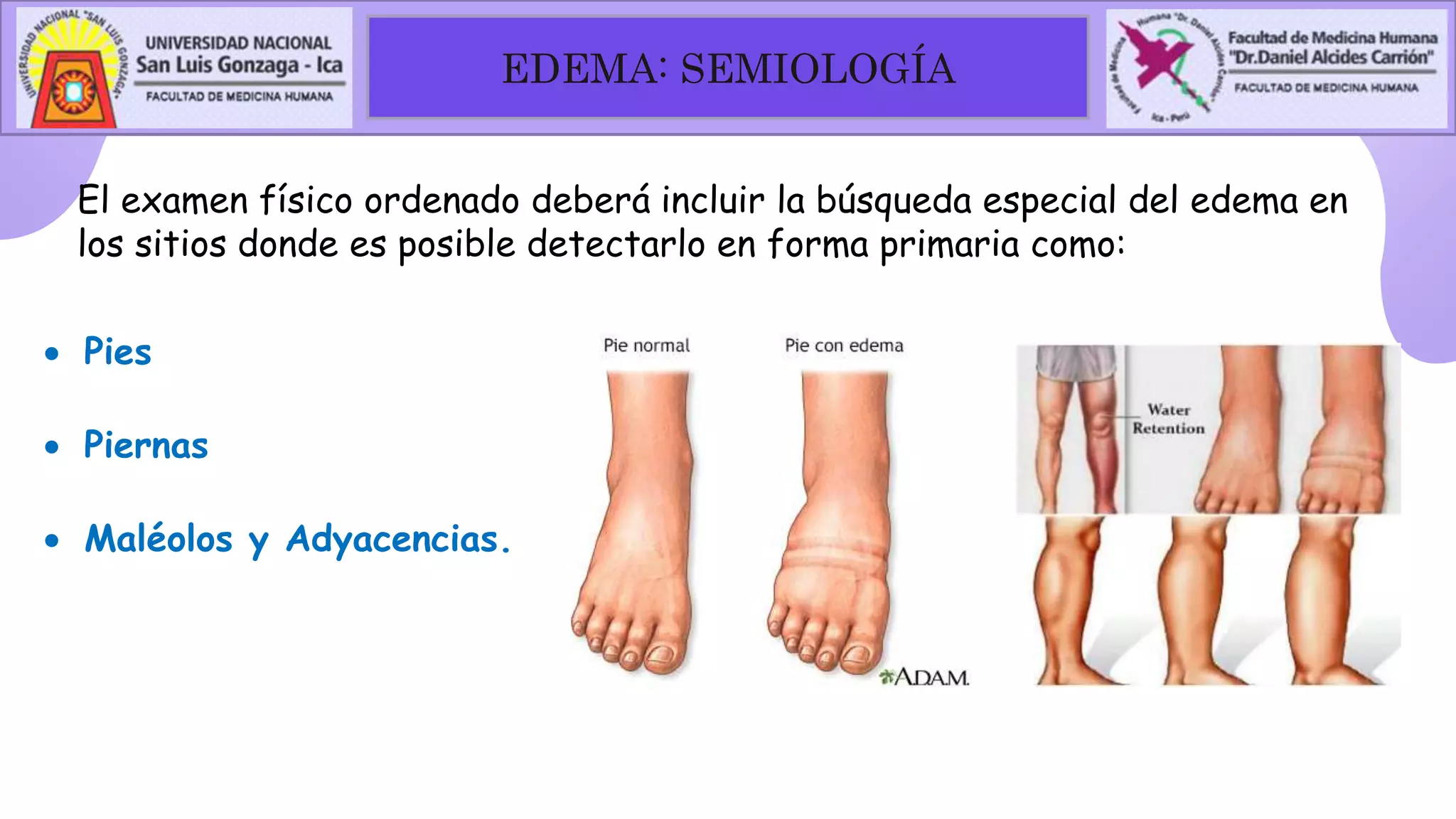 EDEMA_FISIOPATOLOGiATIPOS_Y_CARACTERSTICAS.pptx