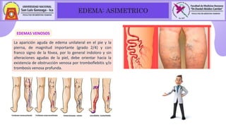 EDEMA_FISIOPATOLOGiATIPOS_Y_CARACTERSTICAS.pptx