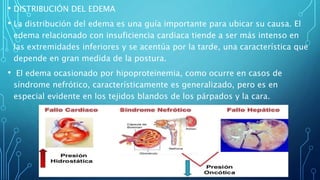 Edema generalizado | PPTX