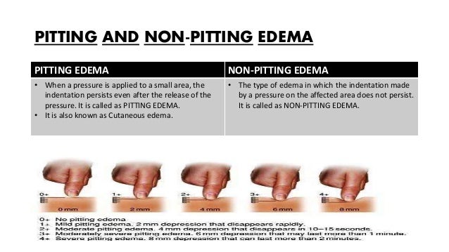 Edema & Haemorrhage