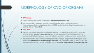 Edema, Hyperaemia, Congestion, Haemorrhage.pptx
