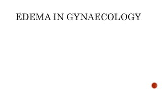 Edema in pregnancy | PPTX