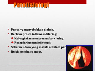 EDEMA LARING | PPT