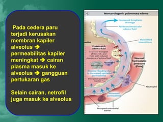 Edema paru | PPT