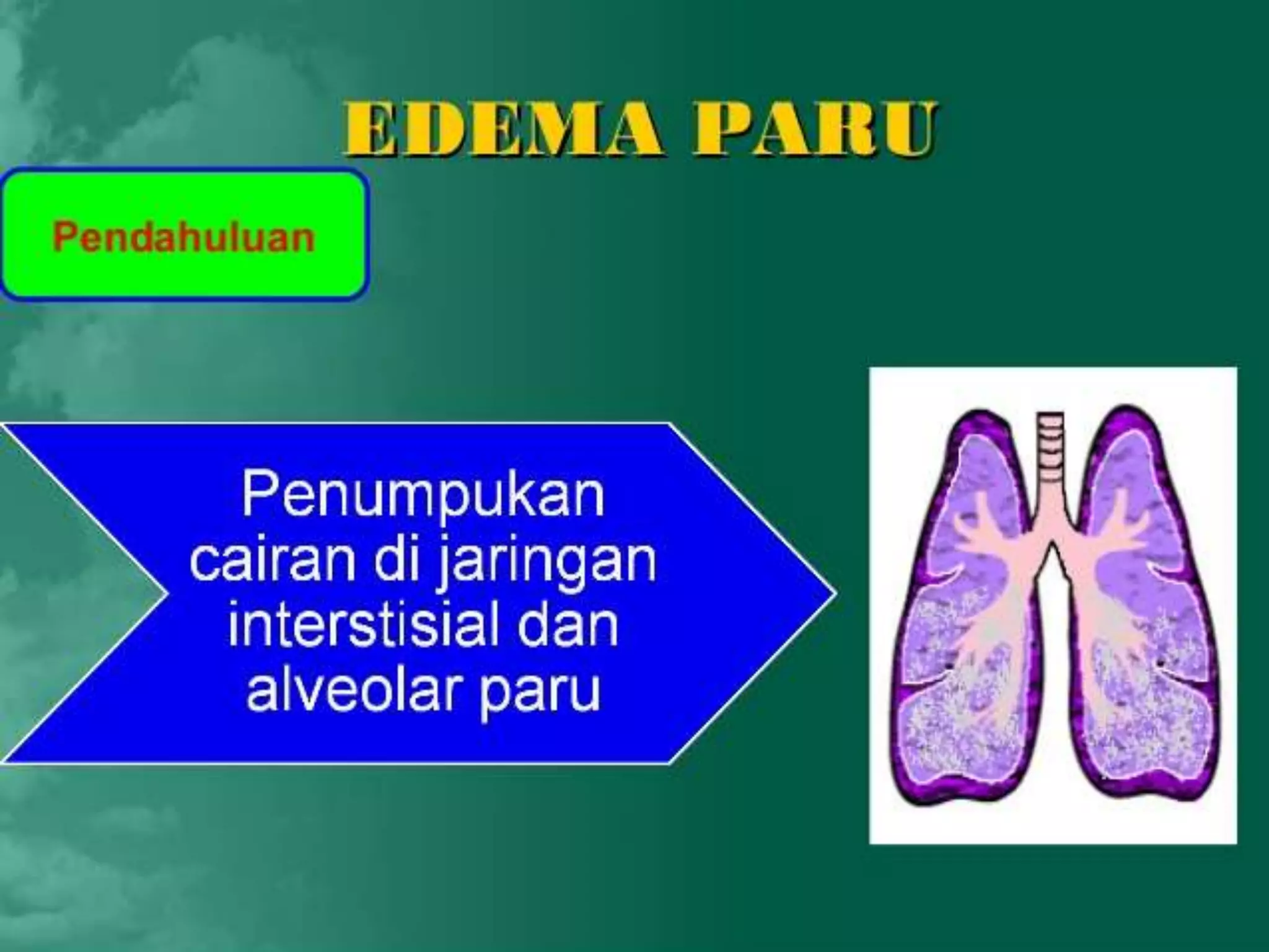 EDEMA PARU....pptx