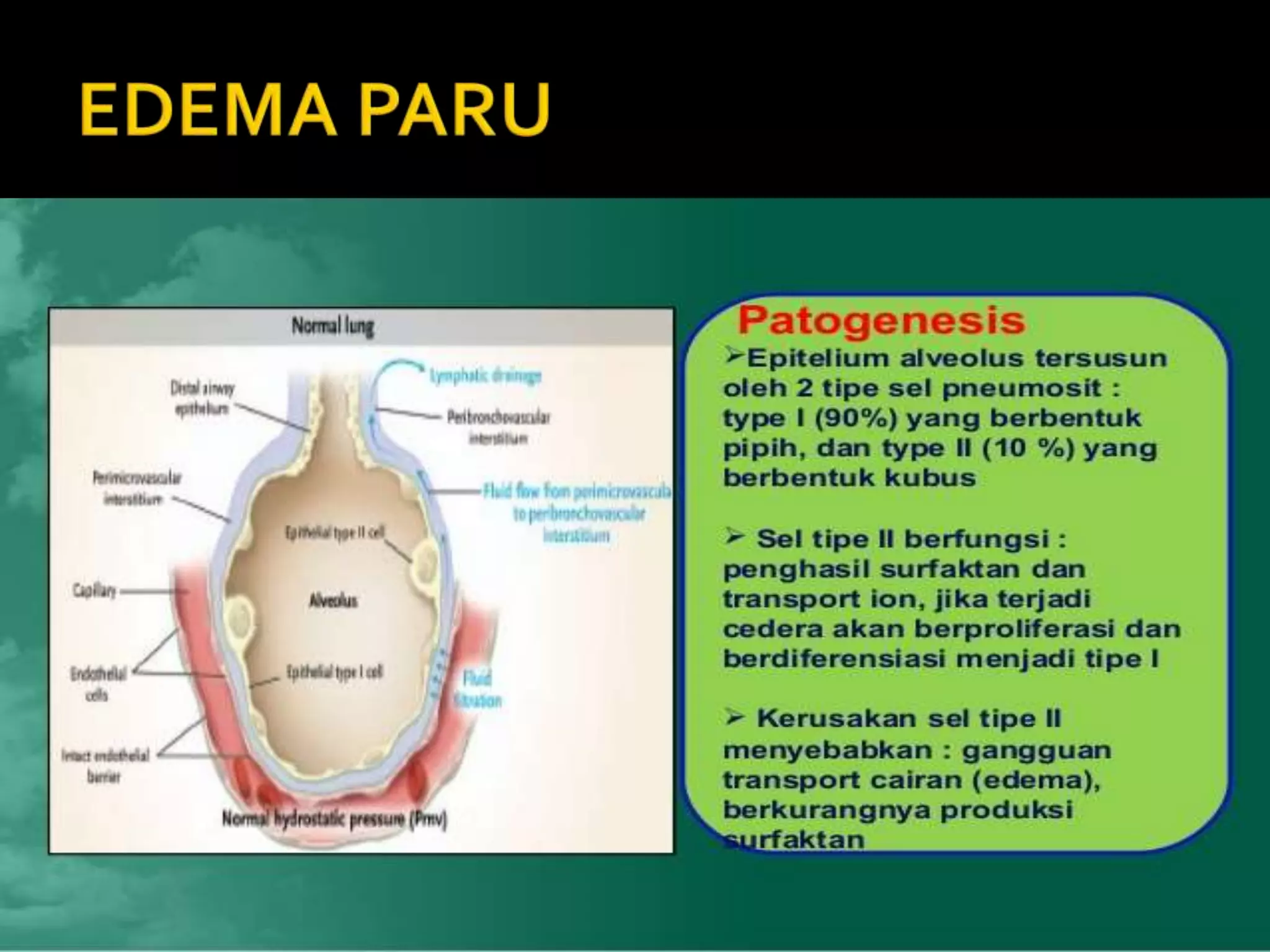 EDEMA PARU....pptx