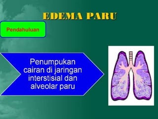 EDEMA PARU....pptx