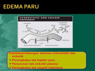 EDEMA PARU....pptx