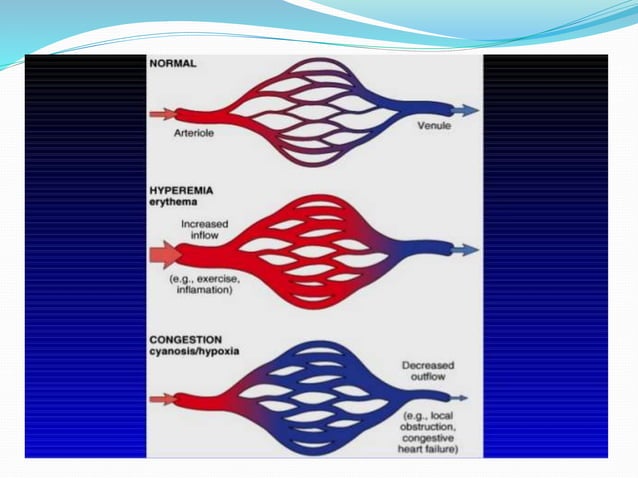 Hyperemia and congestion edema | PPTX