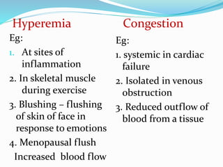 Hyperemia and congestion edema | PPT | Free Download