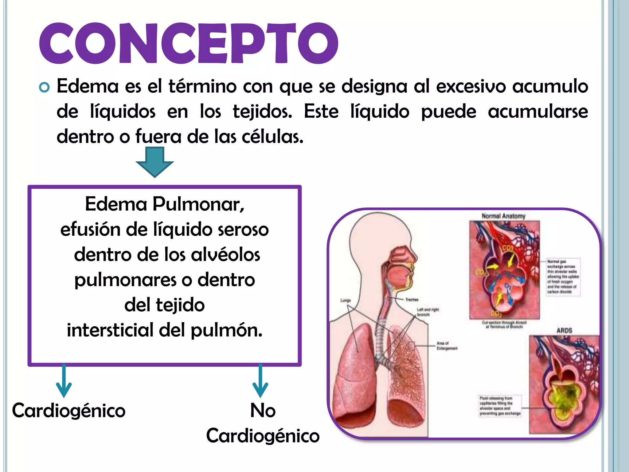 EDEMA PULMONAR I | PPT