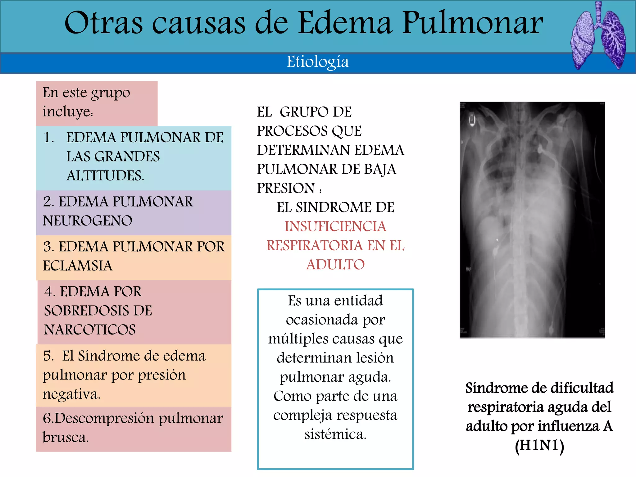 Edema pulmonar agudo y cor pulmonar crónico | PPTX | Lung and ...
