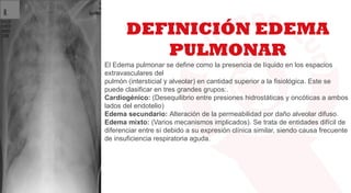 Edema pulmonar: diagnostico por imágenes diagnósticas | PPTX