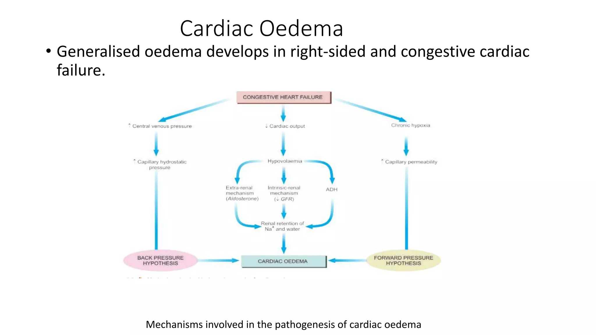 EDEMA,TYPES.pptx
