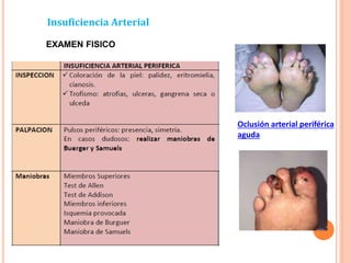 EDEMA VASCULAR con enfoque en semiologia | PPTX