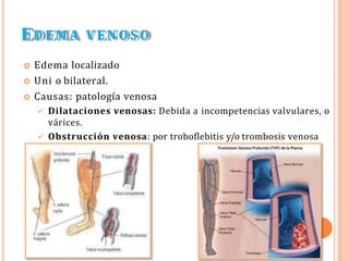 EDEMA VASCULAR con enfoque en semiologia | PPTX