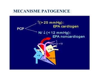 Edemul+pulmonar+acut | PPT