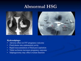 Infertility Overview, Approach and Evaluation | PPT