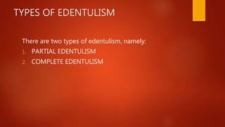 Edentulism | PPTX