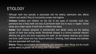 Edentulism | PPT
