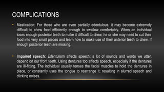Edentulism | PPT