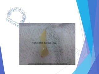 Edentulous Man Ingesting a Bone.pdf