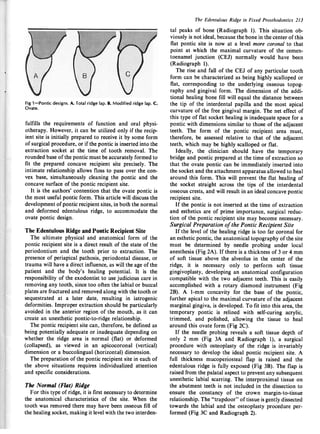 The Edentulous Ridge in Fixed Prosthodontics | PDF