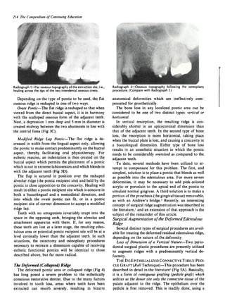 The Edentulous Ridge in Fixed Prosthodontics | PDF