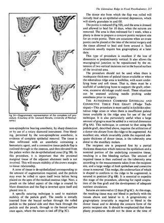 The Edentulous Ridge in Fixed Prosthodontics | PDF
