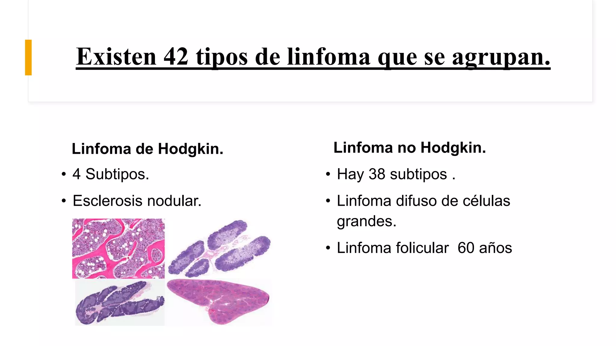 linfoma no hodgkin | PPTX | Cancer | Diseases and Conditions