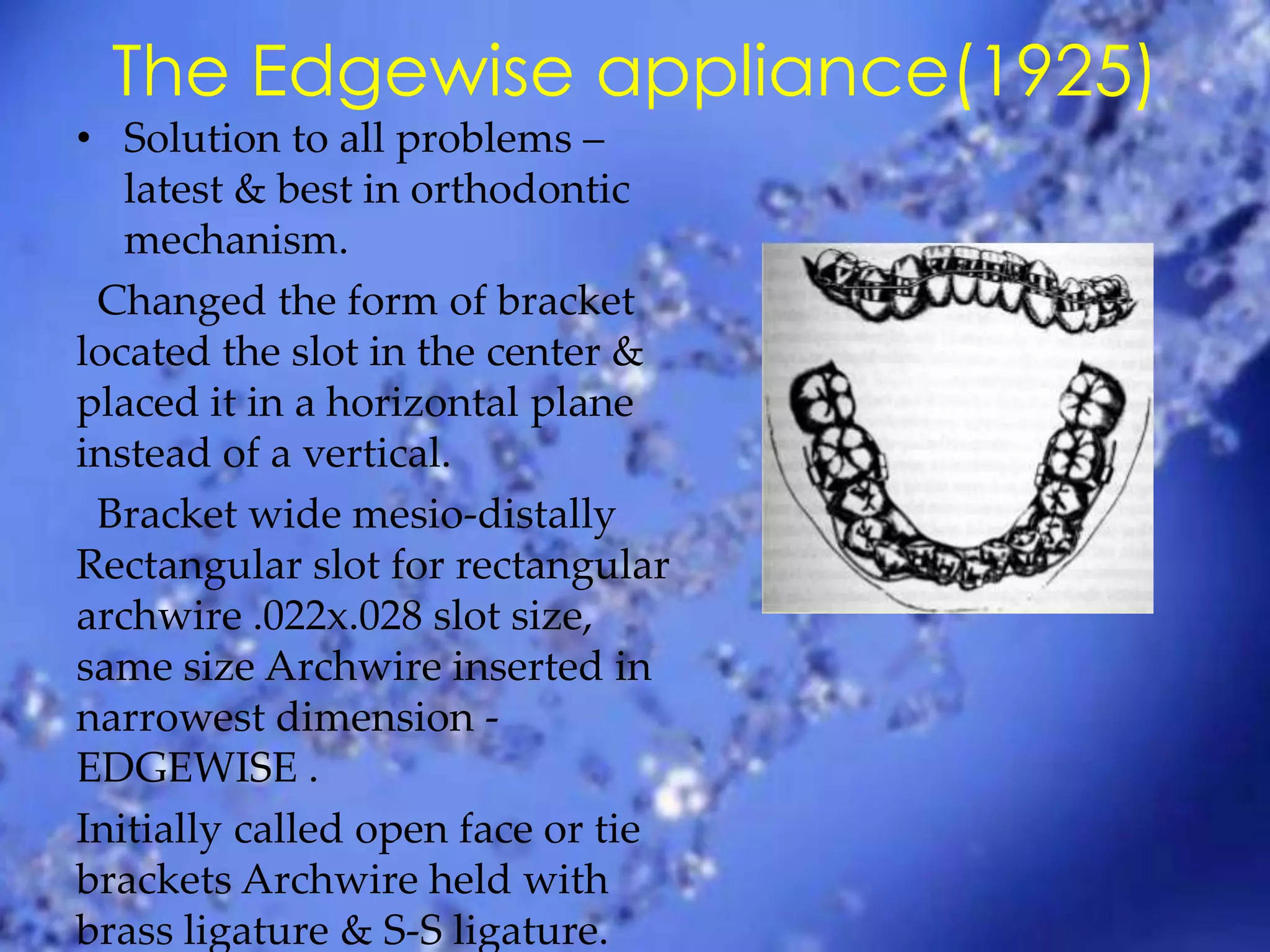 History and evolution of edgewise appliance. | PPTX
