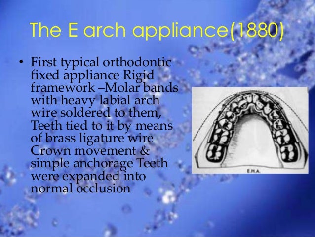 History and evolution of edgewise appliance.