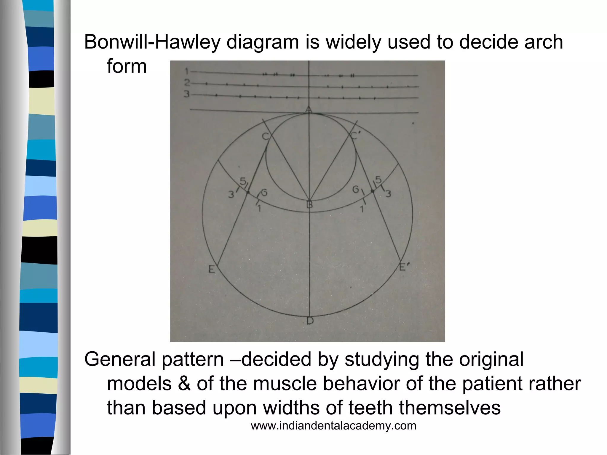 Edgewise technique | PPT