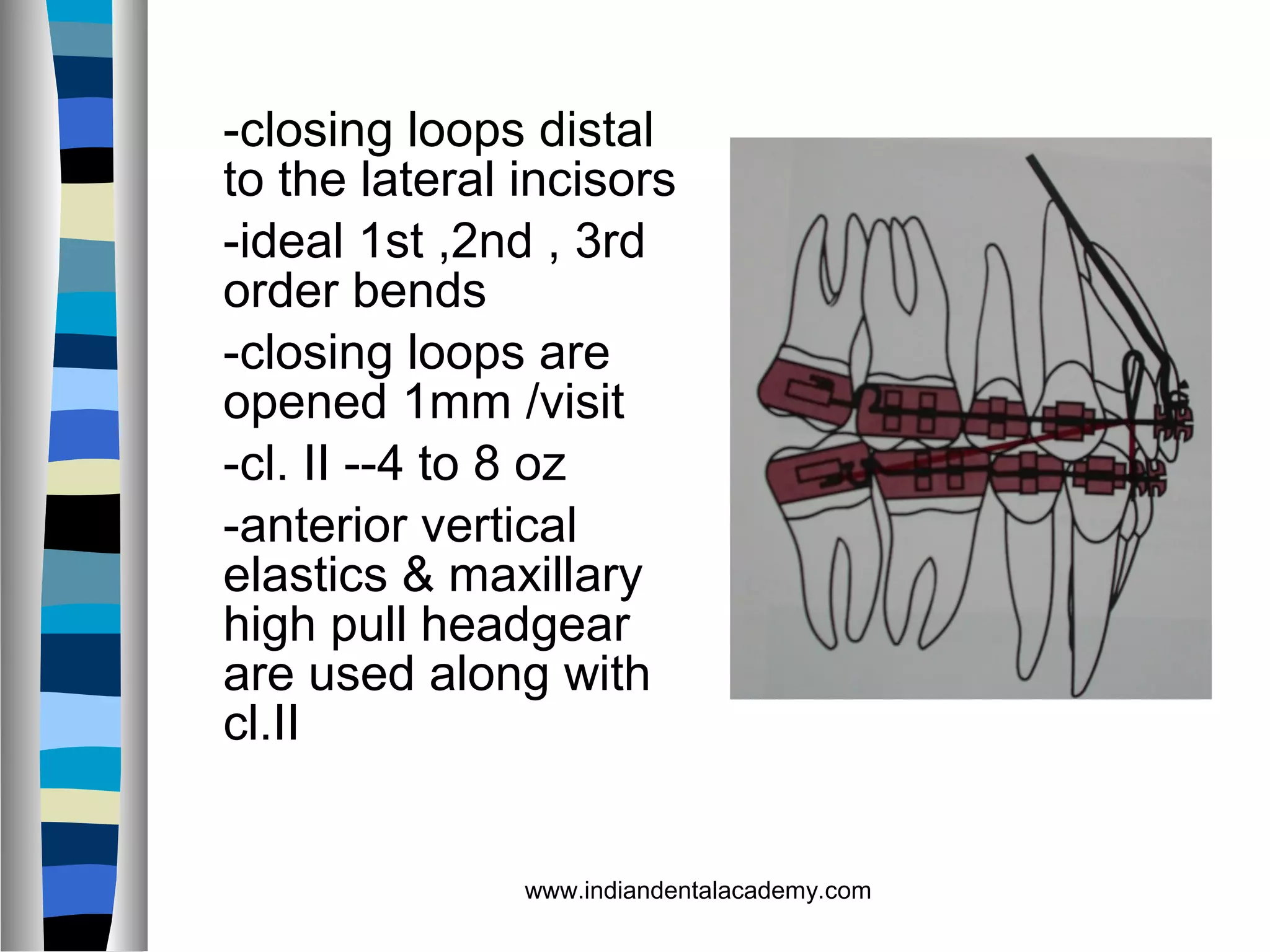 Edgewise technique | PPT