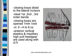Edgewise technique | PPT