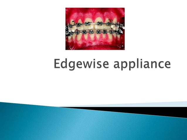 Edgewise appliance | PPTX | Dental Health | Diseases and Conditions
