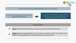 Epidural hematoma management and treatment | PPTX