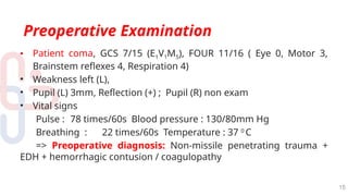 epidural hematoma and penetrating Traumatic brain injury | PPTX