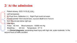 epidural hematoma and penetrating Traumatic brain injury | PPTX