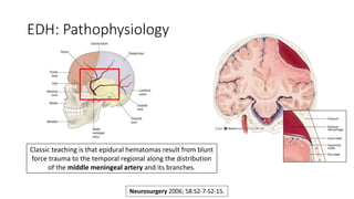 Neuroimaging Mastery Project Presentation #4: Acute Epidural Hematomas | PPT