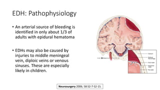 Neuroimaging Mastery Project Presentation #4: Acute Epidural Hematomas ...