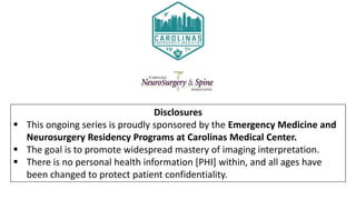 Neuroimaging Mastery Project Presentation #4: Acute Epidural Hematomas | PPT