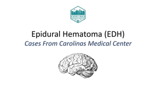 Neuroimaging Mastery Project Presentation #4: Acute Epidural Hematomas | PPT