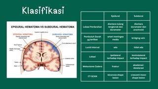 Epidural Hematoma & Subdural Hematom RS Haji.pdf