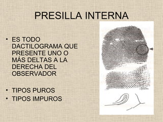 Edisson lopez | PPT