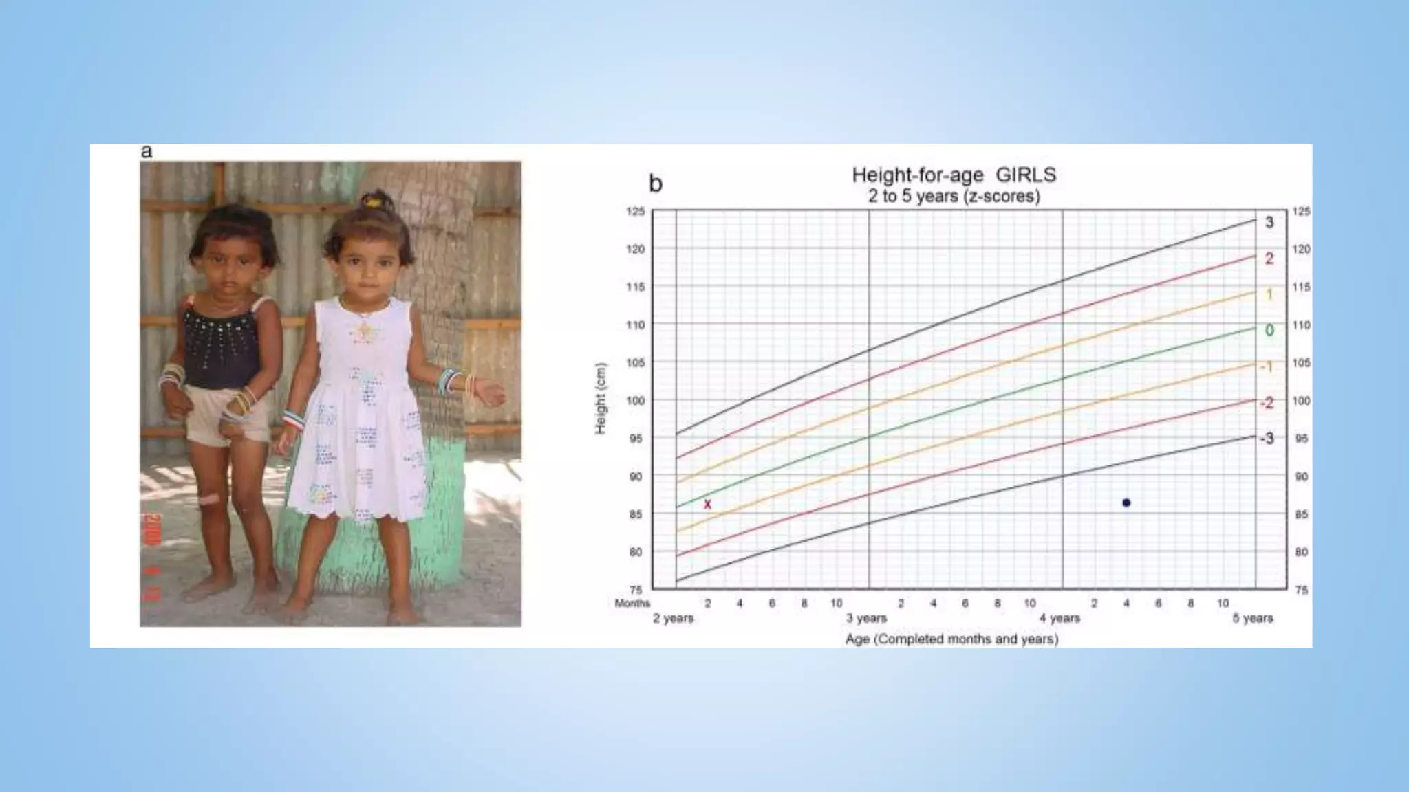 Deteksi dini dan pencegahan STUNTING.pptx