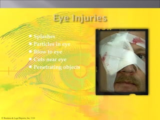 First Aid | PPT